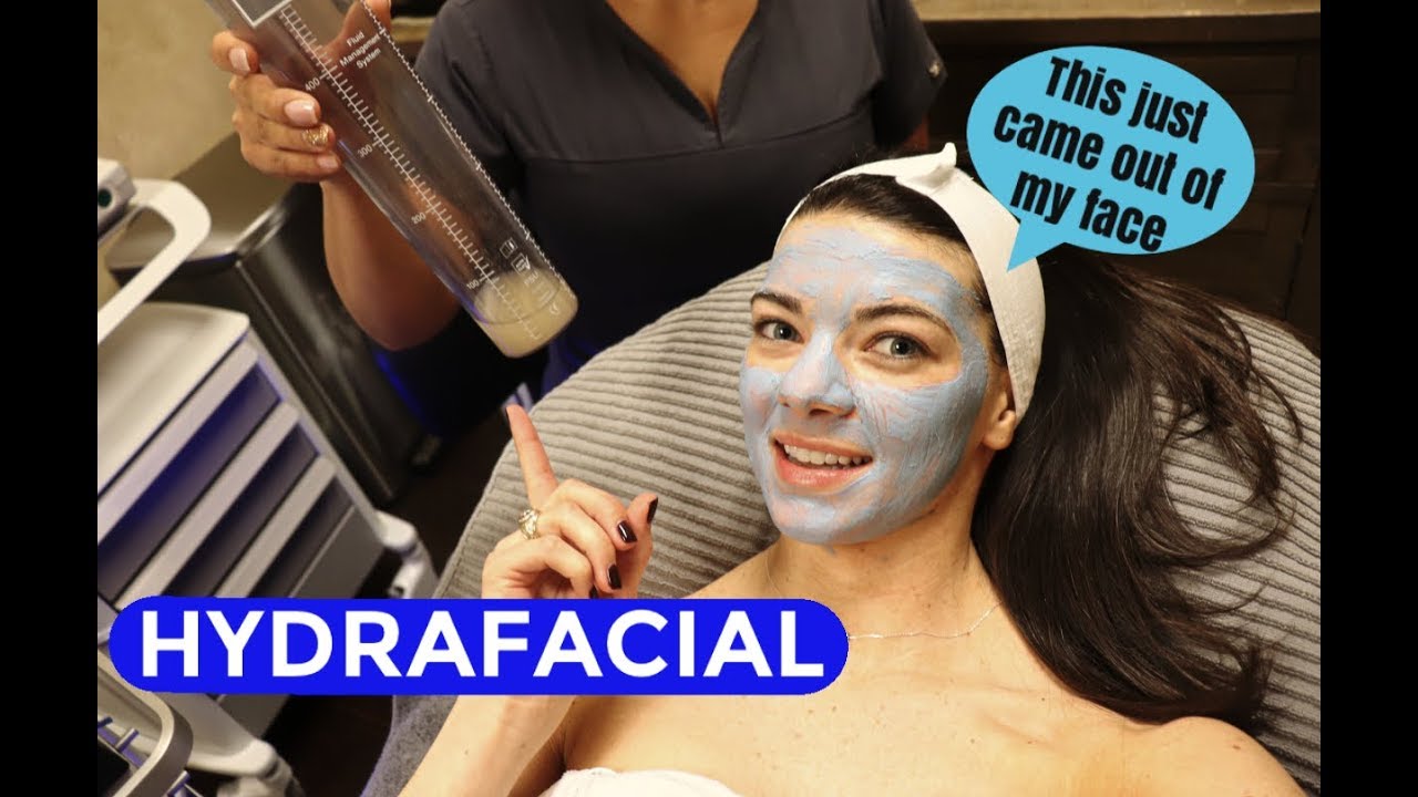 Hydrafacial: My First Time Experience