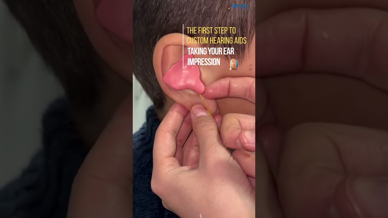 How Ear Impressions Are Taken for Custom Hearing Aids 👂🦻 | Quick Process Explained | Echo Hearing