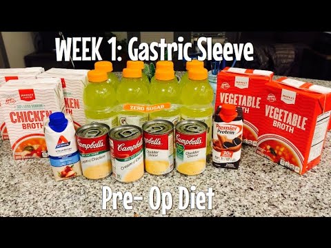 Bariatric Pre Op Diet Plan : Top Picked from our Experts