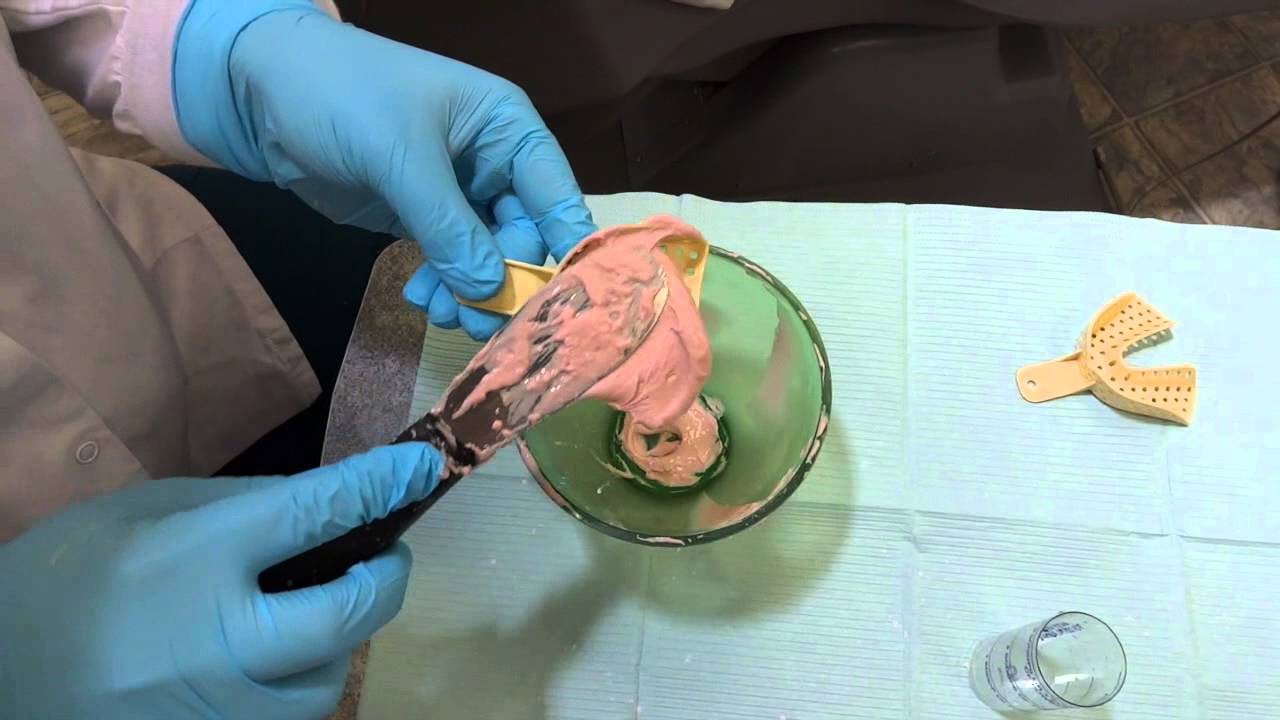 Taking an Awesome Alginate Impression