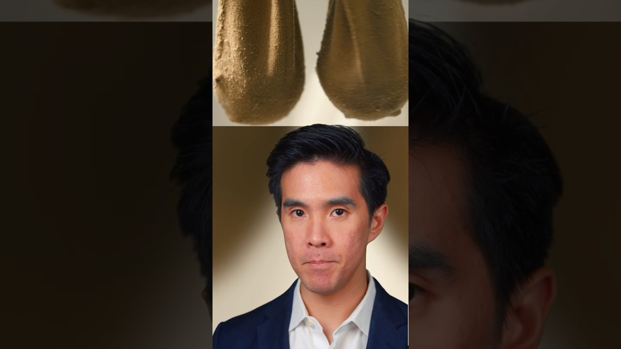 A Boy 👦🏼 Rubbed Pain Relief Cream Between His Legs 😳