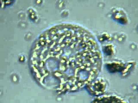 Chlorella : Reproduction captured using Microscope – Me, Science and Life!!
