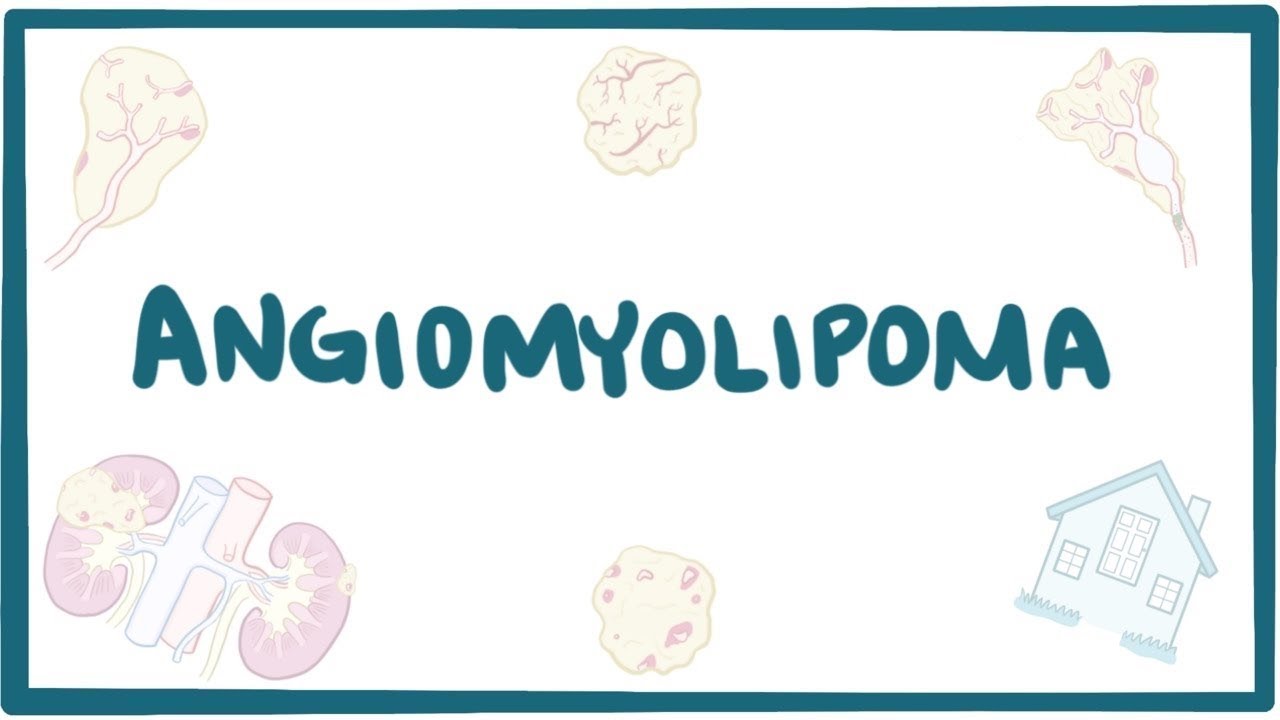Angiomyolipoma - an Osmosis preview