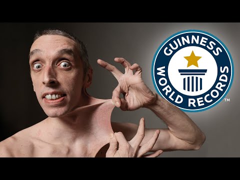 Meet the Real Life Stretch Armstrong | 15 Minute Fun