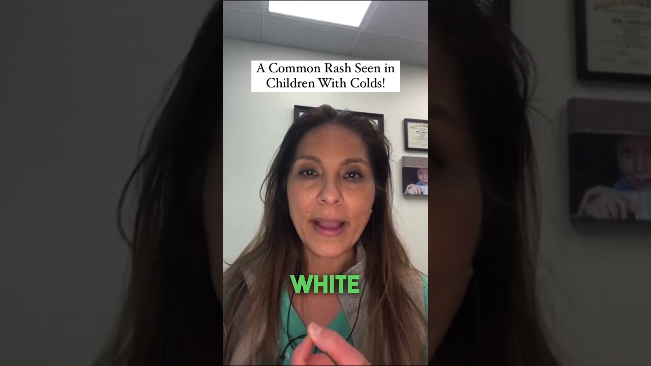 Common Rashes Seen In Kids