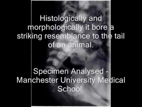 The Human Tail