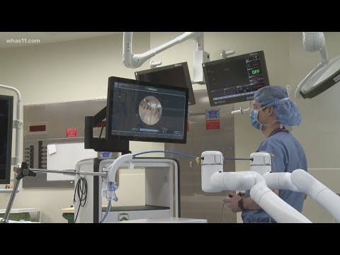 UofL Jewish Hospital using Monarch to help with lung cancer diagnosis