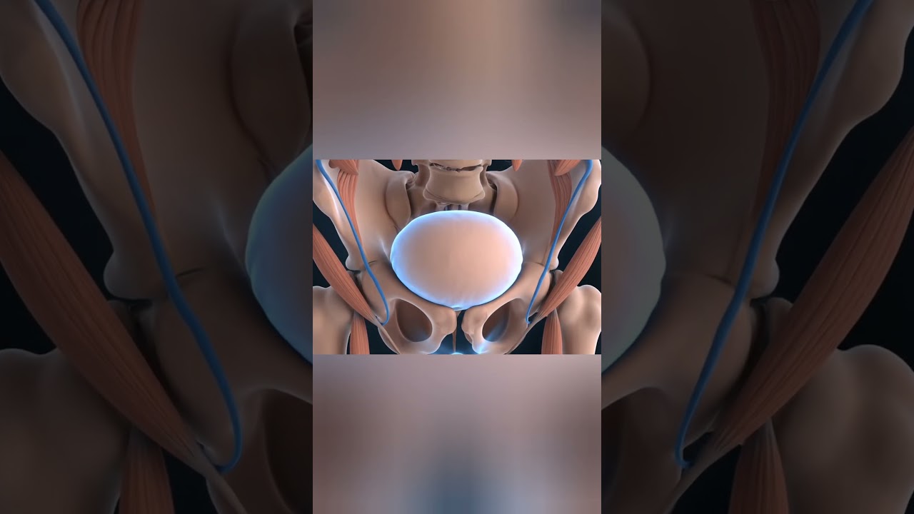 Rectal Prolapse Visualized in 3D