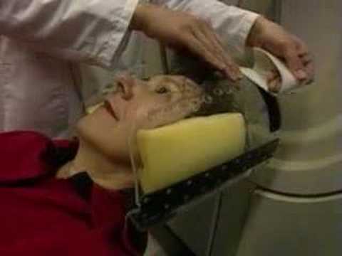 First Look: Alzheimer's (CBS News)
