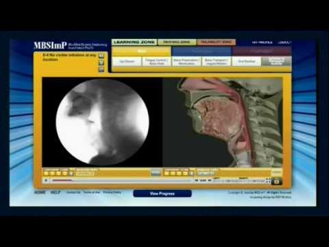 The MBSImP Standardized Clinical Training and Reliability Testing