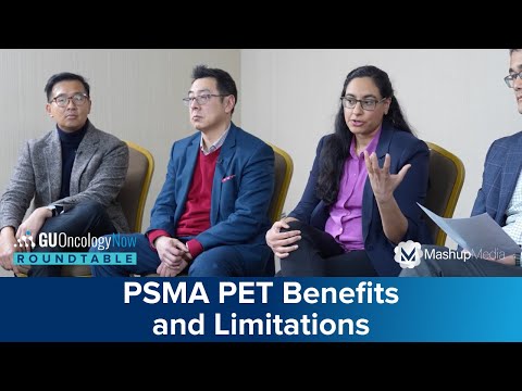 Expert Insights on the Benefits and Limitations of PSMA PET Imaging for Prostate Cancer