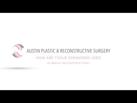 HOW ARE TISSUE EXPANDERS USED IN BREAST RECONSTRUCTION?