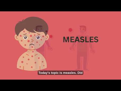 Measles: More Dangerous Than You Think | Shocking Facts You Didn’t Know!