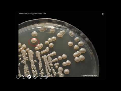 Candida albicans- culture, pathogenesis and laboratory diagnosis