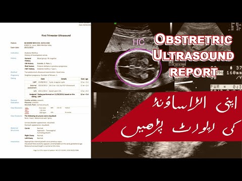 Obstetric Ultrasound Report (Urdu/Hindi)