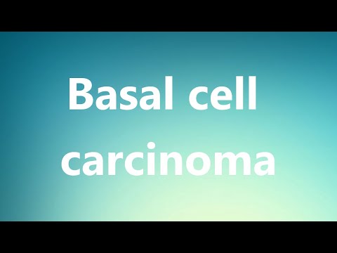 Basal cell carcinoma - Medical Definition