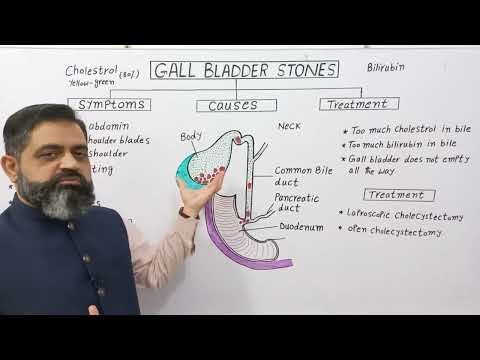 Gall Bladder Stones Urdu/Hindi medium @prof.masoodfuzail| Gall Stones | Treatment of Gall stones
