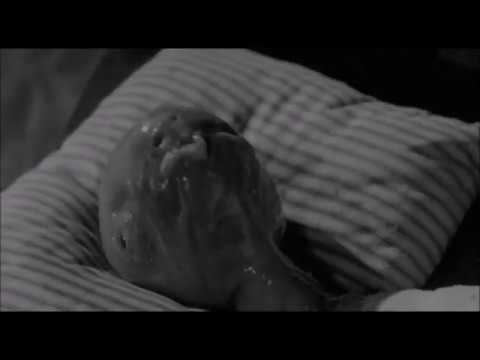 eraserhead baby