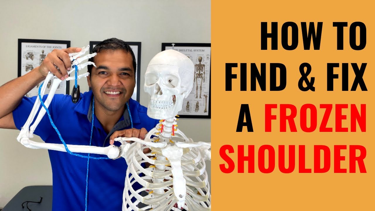 Frozen Shoulder [Adhesive Capsulitis] - Symptoms, Causes & 3 Nifty Exercises To Easily Treat It