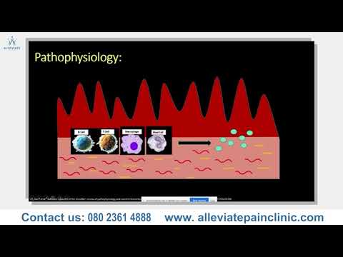 4 Stages of Frozen Shoulder | Pathogenesis, Clinical Features, Symptoms ...