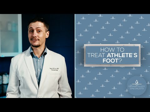 How To Treat Athlete's Foot