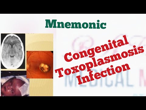 Congenital toxoplasmosis Triad. Mnemonic