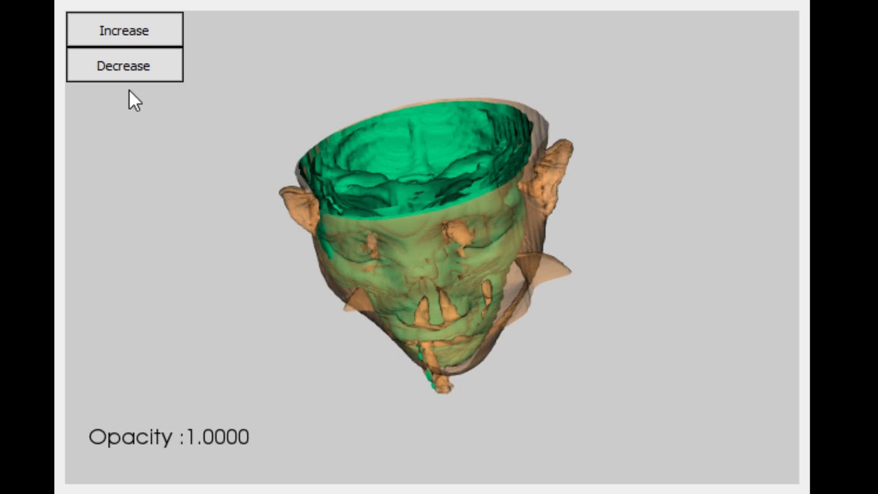 Head visualization VTK(python)