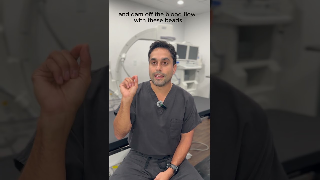 Prostate Artery Embolization - What is it?