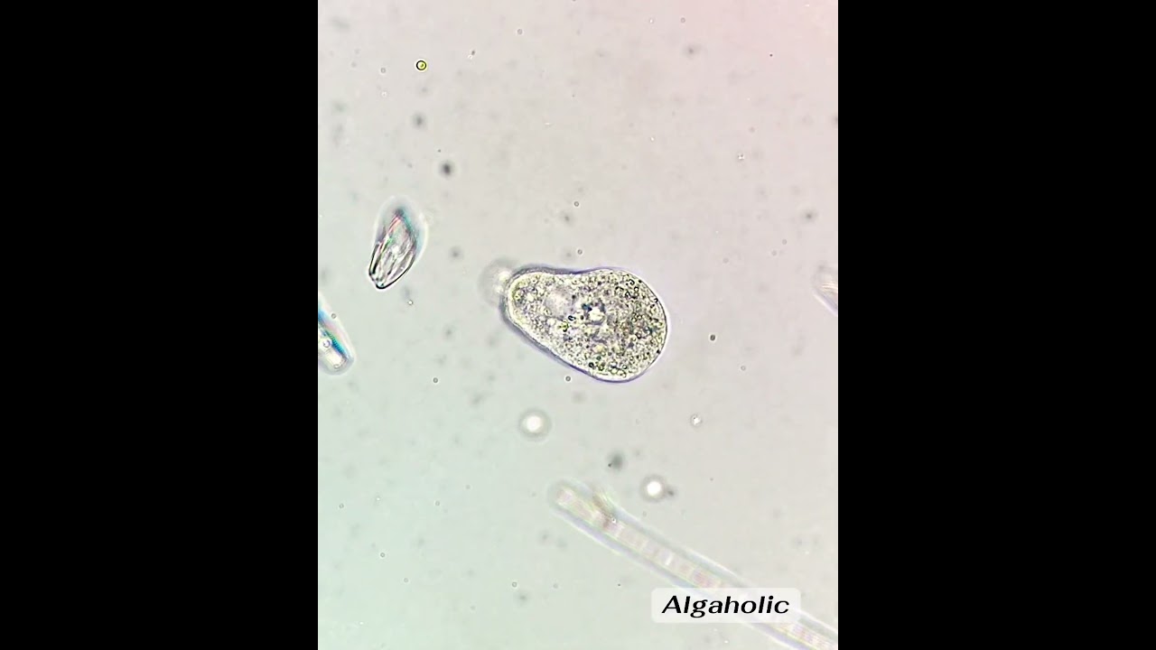 Amoebozoa from freshwater. #Amoebozoa #pseudopodia #microscope