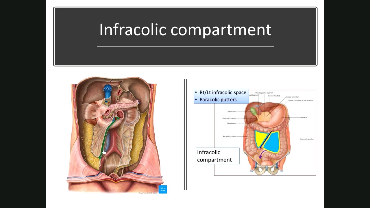 Greater sac (Peritoneum 6)
