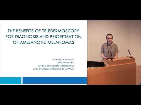The benefits of teledermoscopy for diagnosis and prioritisation of amelanotic melanomas