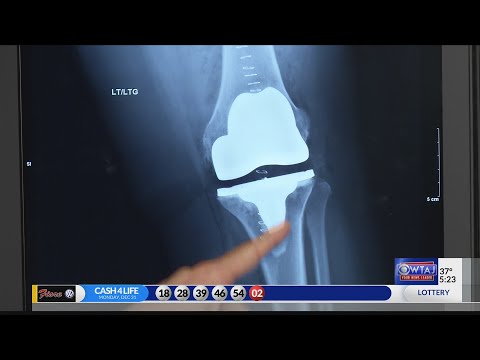 Alternatives to knee replacement