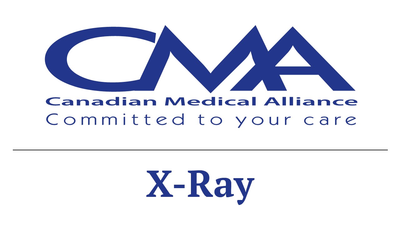 CMA X Ray