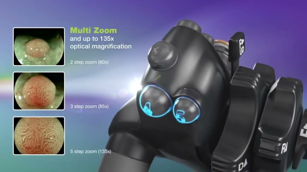 Видеоэндоскопическая система на Fujinon ELUXEO Lite EP-6000 - купить в ...