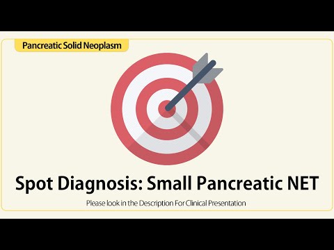 Spot Diagnosis: Small Pancreatic NET