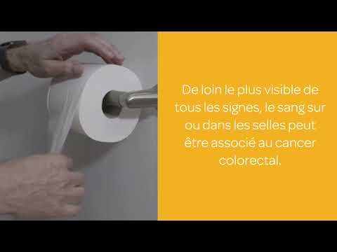 Les symptômes du cancer du colon, les examens de dépistage. Centre de cancérologie Les Dentellières