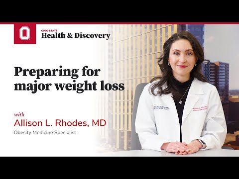 How to prepare yourself for major weight loss | Ohio State Medical Center