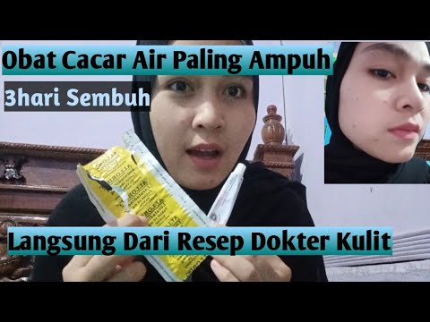 OBAT CACAR PALING AMPUH ||3 HARI LANGSUNG SEMBUH