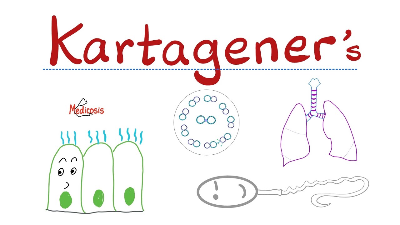 Kartagener's Syndrome - Immotile Cilia Syndrome - Primary Ciliary Dyskinesia - Pulmonology
