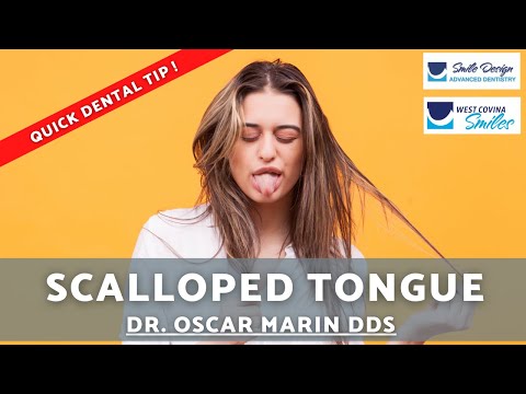 Scalloped Tongue