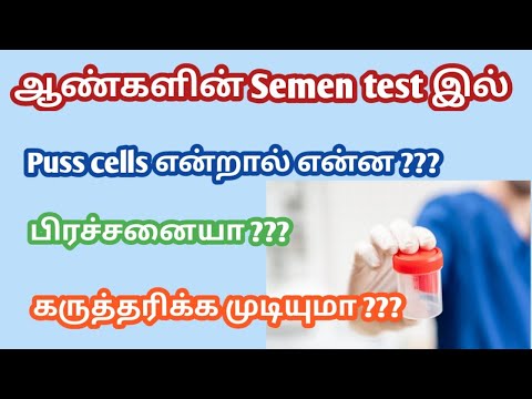 what is pus cells in semen test in tamil | what is the normal range of puscells in tamil