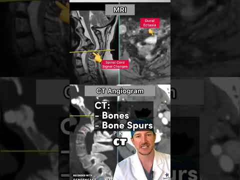 MRI vs CT scan for your back and spine!!