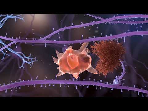 What is Alzheimer’s disease and treatment animated in urdu and hindi. (Narrated by: Dr. Ahmad Siyal)