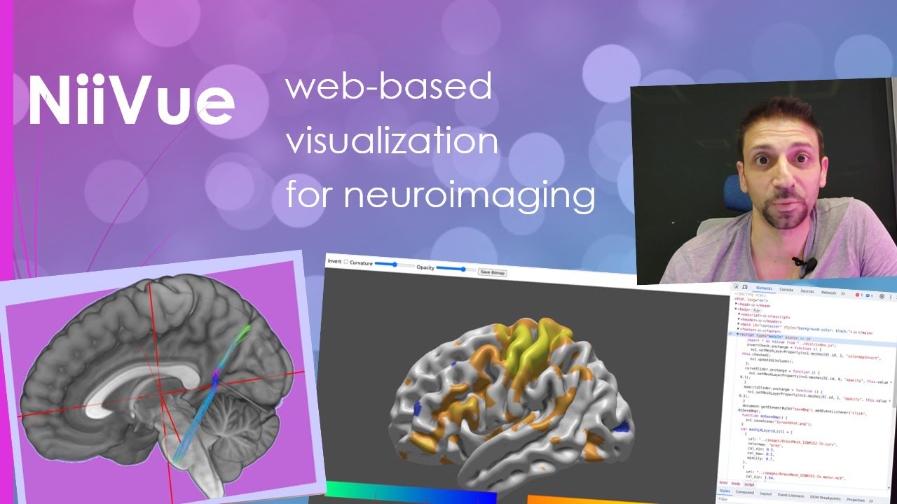 NiiVue is web-based visualization tool for neuroimaging using html and javascript/webgl loading Nii