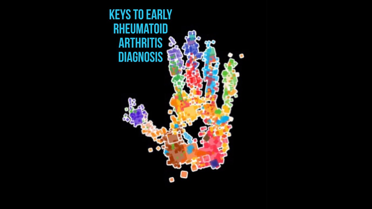 Keys to Early Rheumatoid Arthritis diagnosis - Chicago Arthritis and ...