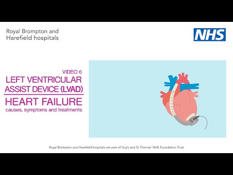 Video 6 | Left ventricular assist device (LVAD)
