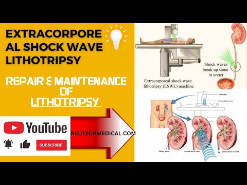 What is Lithotripsy| Extracorporeal Shock Wave Lithotripsy| procedure of Shockwave Lithotripsy