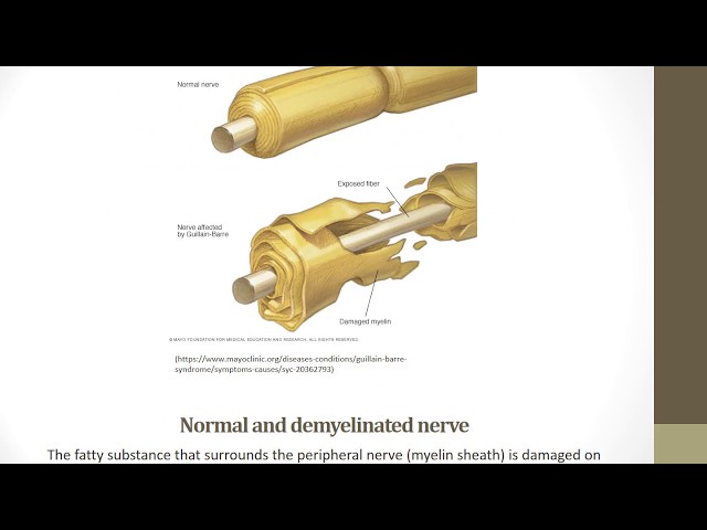 How to pronounce myoparesis | HowToPronounce.com