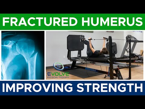 Fractured Humerus | Improving Strength | Part 1