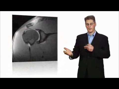 Shoulderdoc Labrum.mov
